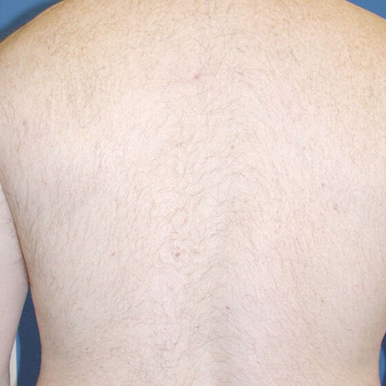 Industry-Leading Aesthetic Platform - Icon® - Cynosure