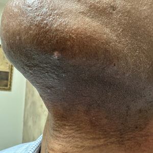 Aesthetic Machine | Elite iQ™ | Cynosure